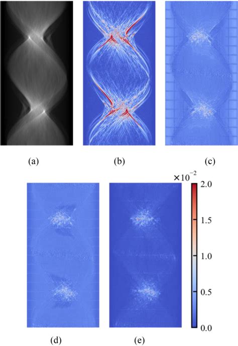 Figure 5 From Artifact Reduction For Sparse View Ct Using Deep Learning