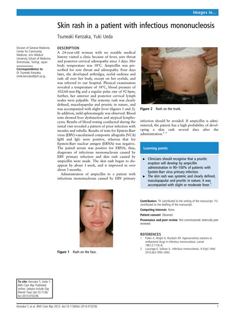 Pdf Skin Rash In A Patient With Infectious Mononucleosis