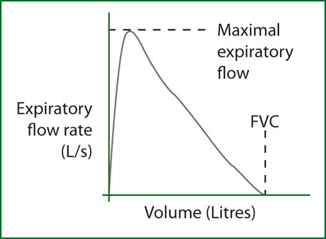 spiroconnect physiology medchip