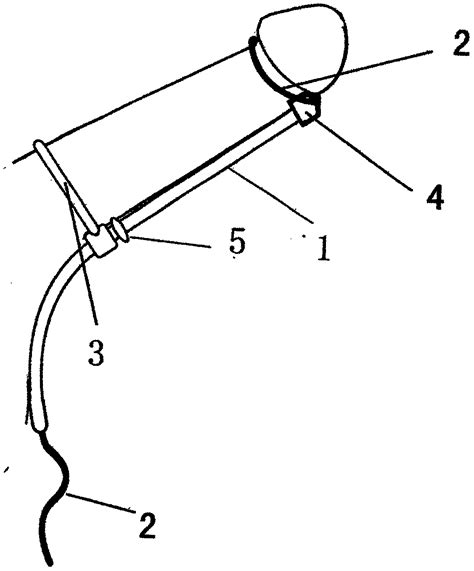 External Penis Support Eureka Patsnap