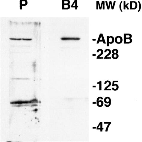 Model Of Apob Structure In The Membrane Of The Endoplasmic Reticulum Download Scientific