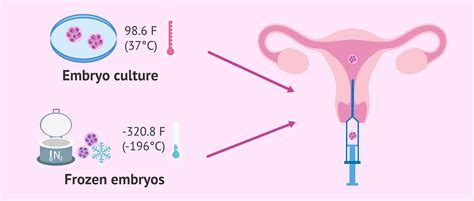 Fresh Or Frozen Embryo Transfer