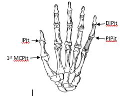Interphalangeal Joints