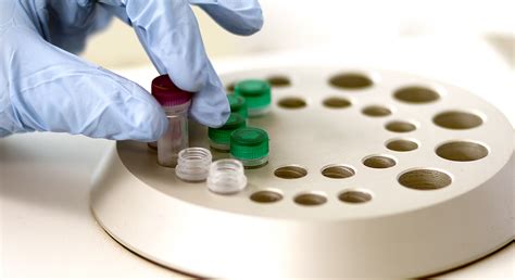 Platelet Function Testing In Drug Discovery Projects Considerations And Challenges Platelet