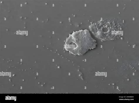 This Scanning Electron Microscope Sem Image Revealed Some Of The