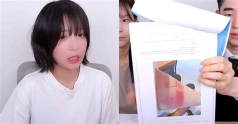 쯔양 온몸 피멍으로 뒤덮여남친에 맞은 부위 공개