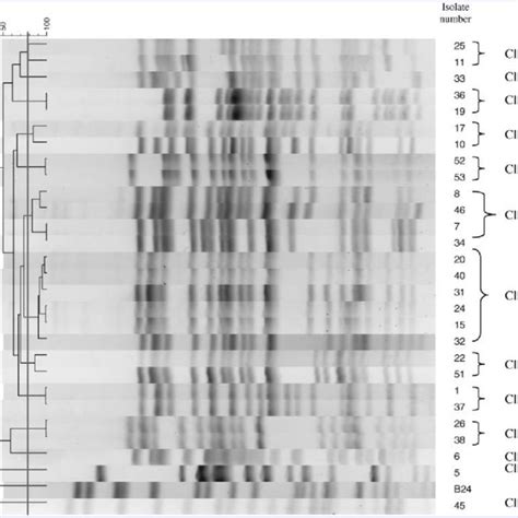 Dendrogram Generated By Bionumerics Software Applied Maths Kortrijk