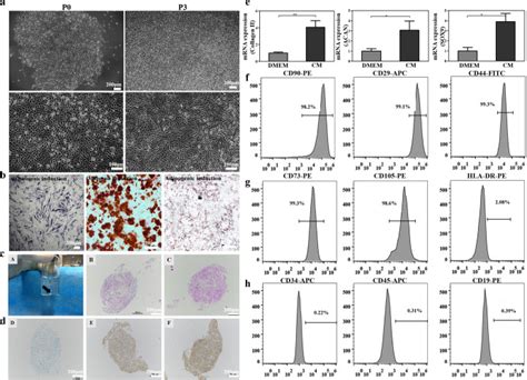 Injectable Decellularized Cartilage Matrix Hydrogel Encapsulating Urine Derived Stem Cells For
