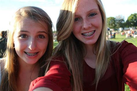 Braces