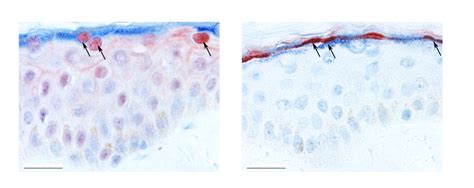 Pdf Human Papillomavirus Type 8 Interferes With A Novel Cebp