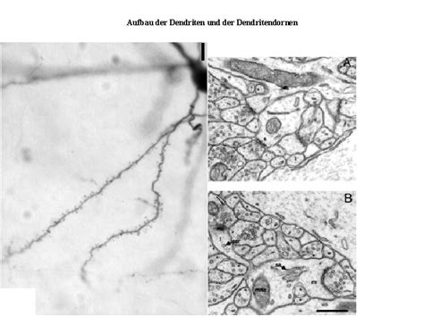 Neurone Axon Dendrit Synapse Proliferation Und Differenzierung Im