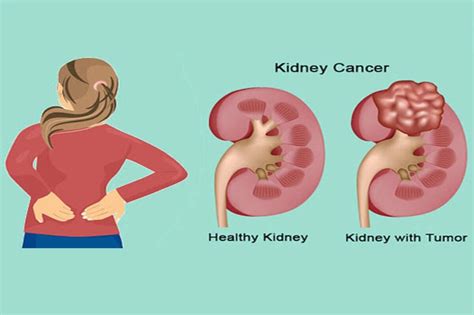 U Th N C Nguy Hi M Kh Ng Nguy N Nh N Tri U Ch Ng V Bi N Ph P Ph Ng Ng A Nh Thu C Fpt Long