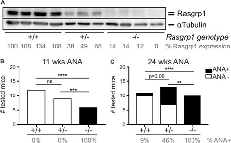 dysregulated rasgrp1 expression through runx1 mediated transcription