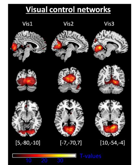 Figure 1 From Mindfulness Is Associated With Intrinsic Functional Connectivity Between Default