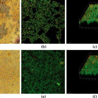 Microscopy Images Of Planktonic Cells And Biofilms Of Candida Auris