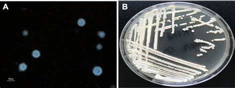 Cryptococcus Neoformans Culture
