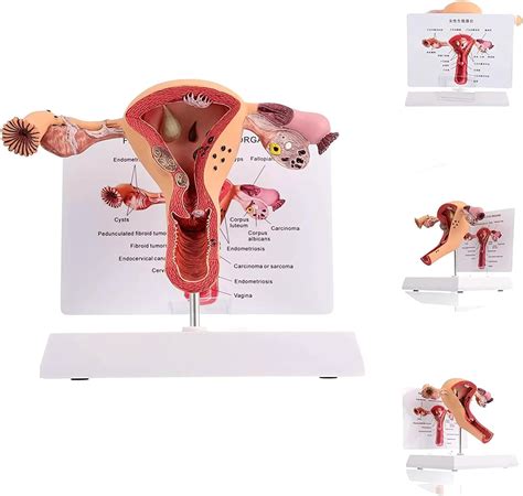 3d Human Uterus Model Uterus Model Ovary Model Human Kosovo Ubuy
