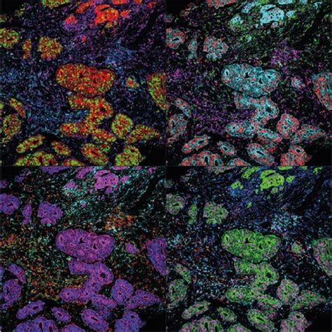 Cancer Immunogenomics Lumc