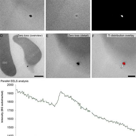 Electron Tomography Of A 250 Nm Thick Section A Tilt Series Three Download High Quality