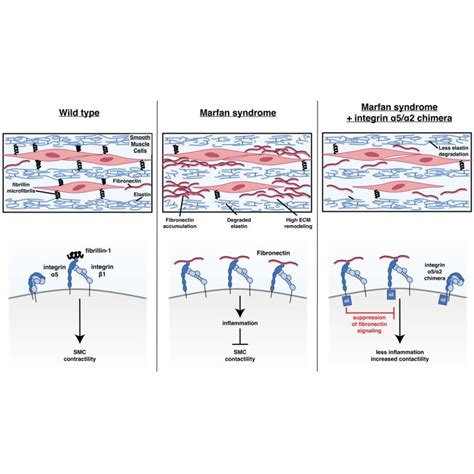 Fibronectin In The Aortic Wall Binding To Integrin α5β1 Promotes Aneurysm Progression In Marfan