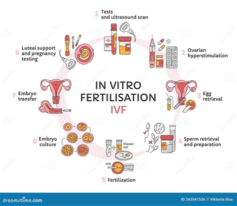 Infographic In Vitro Fertilization Vector Illustration Cartoondealer