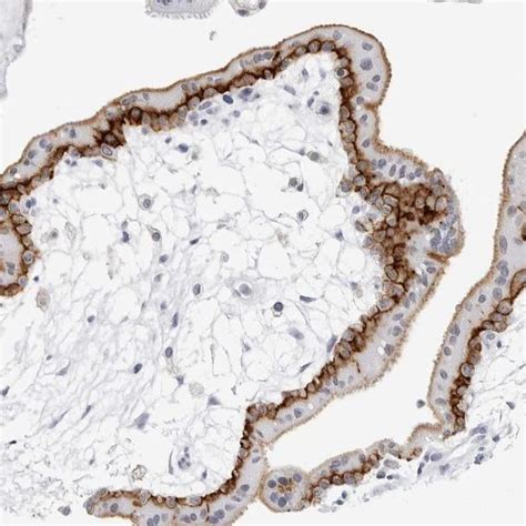 SLC19A1 Antibody PA5 55190