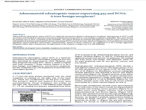 Adenomatoid Odontogenic Tumor Expressing P53 And Pcna A True Benign