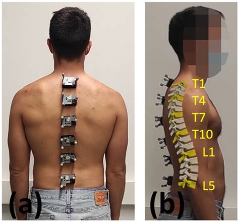 determination of the 3d human spine posture from wearable inertial sensors and a multibody model