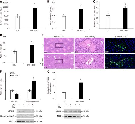 Uridine Diphosphate Glucuronosyltransferase 1a1 Prevents The