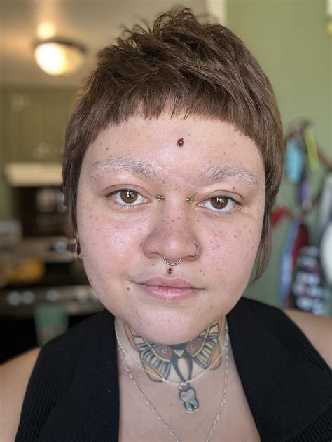 Got My Forehead Dermal Rpiercing