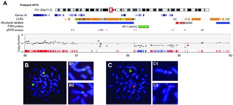 Identification Of Lcr Mediated Mosaic Deletion Using Snp Arrays A
