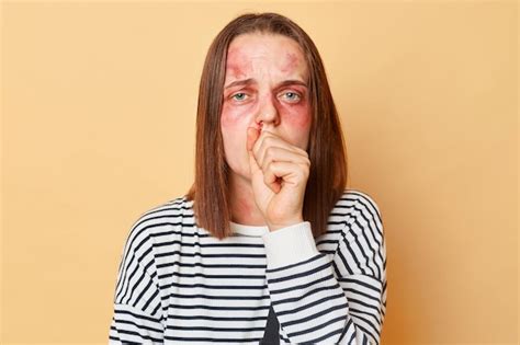 Premium Photo Unhealthy Woman With Bruises And Injuries Wearing