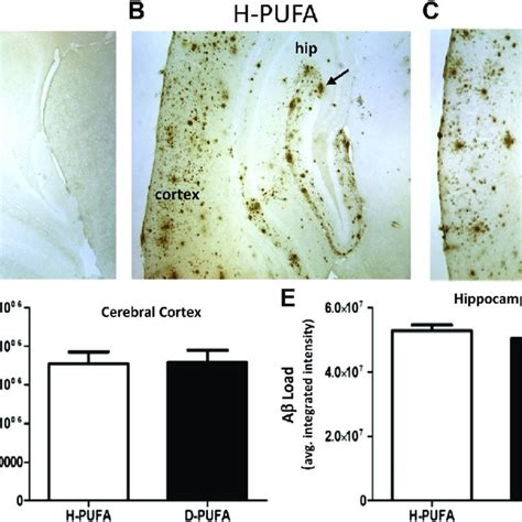 The Amounts Of Ab Deposits In The Cerebral Cortex And Hippocampus Are Download Scientific