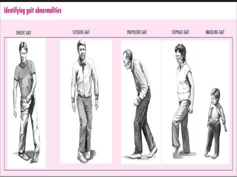 Gait Abnormalities Presentation Pptx