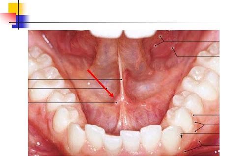 Whartons Duct Food Oral Cavity Cavities