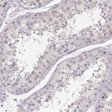 Rabbit Polyclonal Anti Pnp Antibody Buy For Research Highly