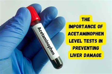 Learn About Acetaminophen Level Test Marvel Path Lab Posted On The