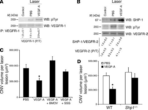 Figure 2 From Loss Of Sparc Mediated Vegfr 1 Suppression After Injury