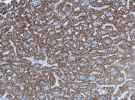 Anti Ubiquinol Cytochrome C Reductase Core Protein I Antibody Ab96333