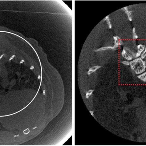 The In Vivo Micro Ct Image Reconstructed By A Fbp Approach With Ramp