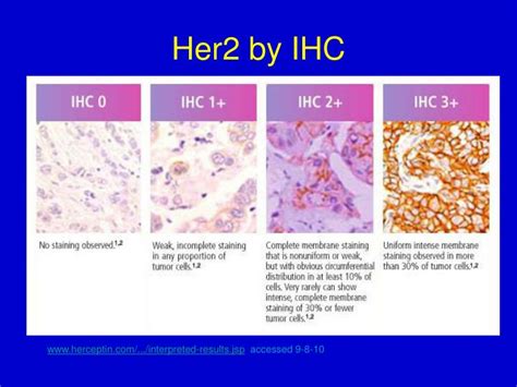 Ppt Tumor Biomarkers Powerpoint Presentation Id 1274352
