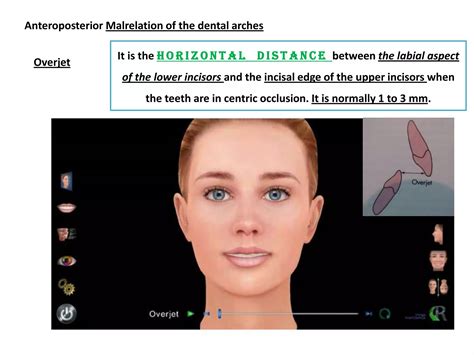 Classification Of Occlusion And Malocclusion Dr Nabil Al Zubair Pdf Classification Of Occlusion And Malocclusion Dr Nabil Al Zubair Pdf