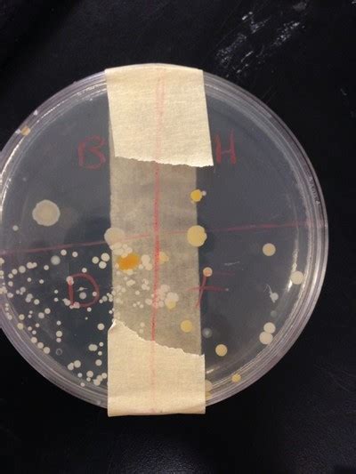 Bacteria Lab Part Biology