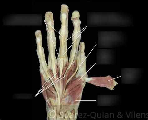 Diagram Of Prosection Image 2 Lumbricals On Palm Quizlet
