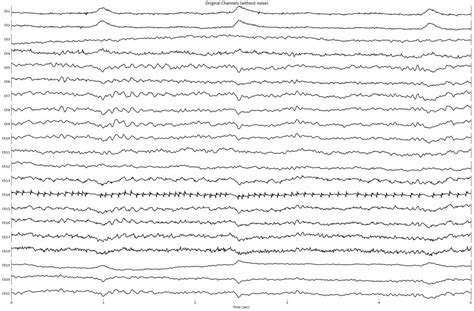 Arya Koureshi On Linkedin Eeg Datascience Neuroscience