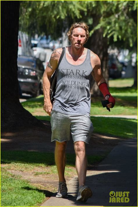 Dax Shepard Steps Out In A Cast After Performing Surgery On Himself