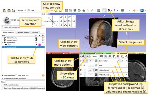 3d Slicer：从入门到精通（二）——入门指南3dslicer Csdn博客