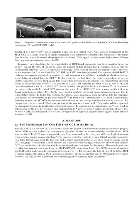 Segmentation Of Retinal Low Cost Optical Coherence Tomography Images