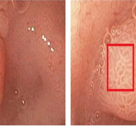 Restoration Effect Of Criminisi Algorithm When Dp 1 A Original