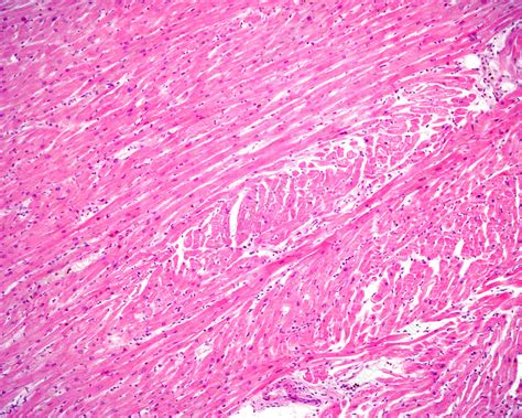 Heart Myocardium Light Micrograph Stock Image C055 4014 Science Photo Library